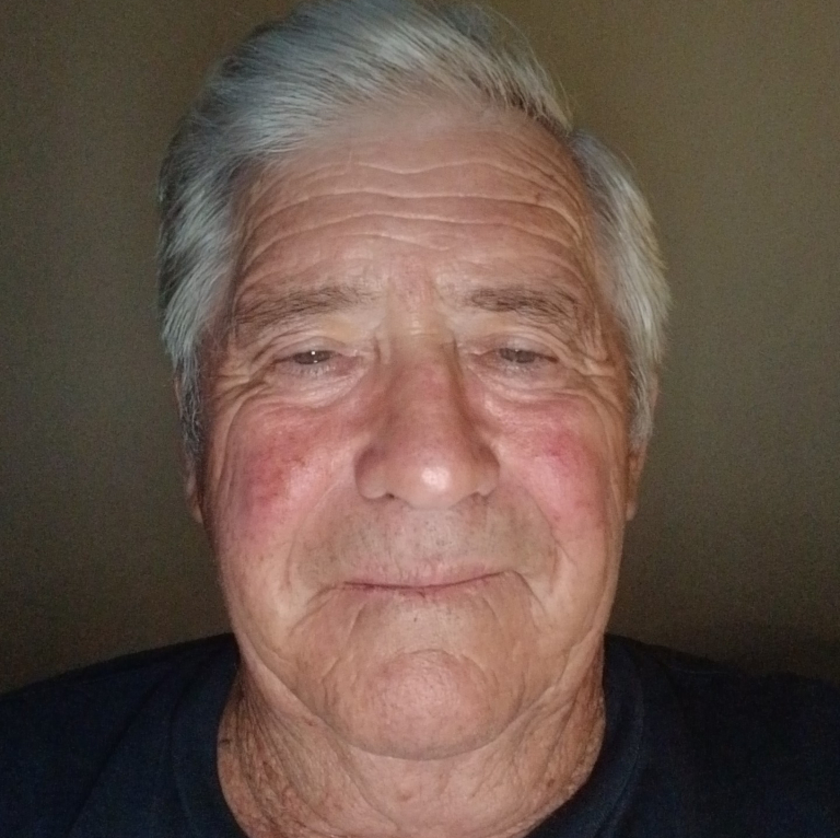 Frank's story - MPN Alliance Australia